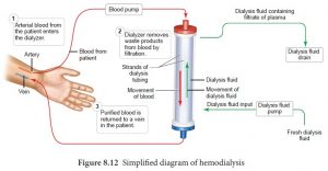 Dialysis Diagram -Class 10 - CBSE Class Notes Online - Classnotes123