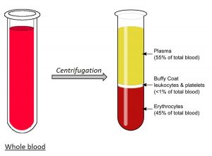 Difference between Lymph and Plasma - CBSE Class Notes Online ...